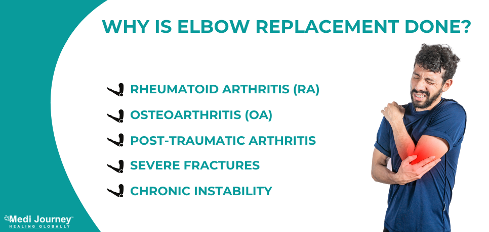 Elbow Replacement: Types, Procedure, and Recovery
