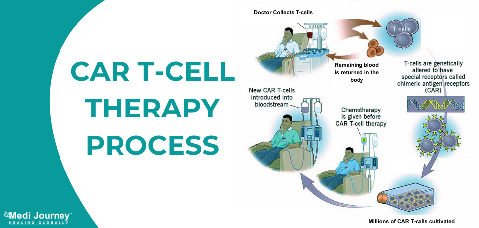 CAR T-Cell Therapy: What it is and how it works